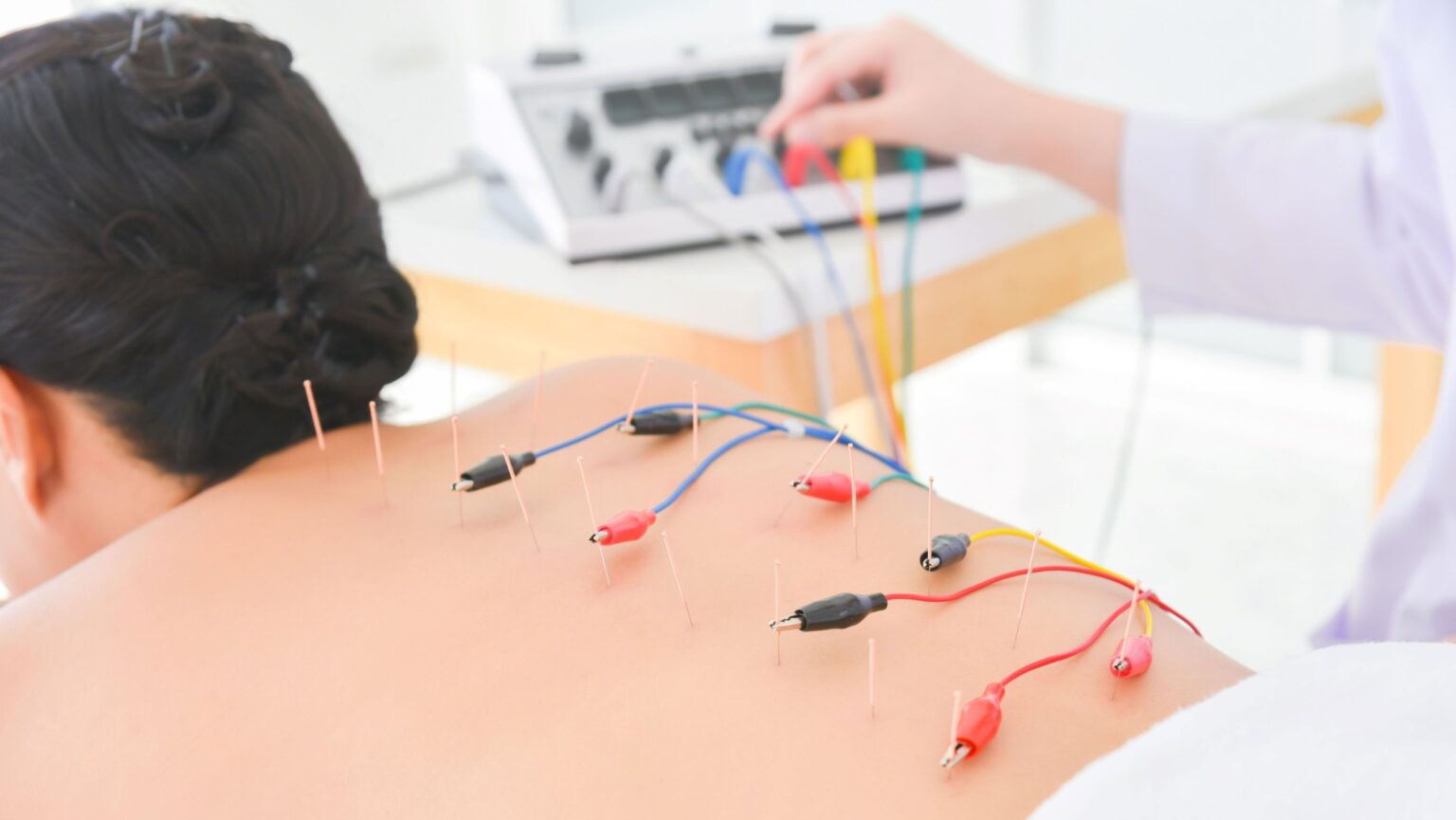 Adding electroacupuncture to standard triple antiemetic therapy ...