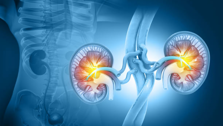 Understanding Kidney Cancer: Causes, Symptoms, and Prevention ...