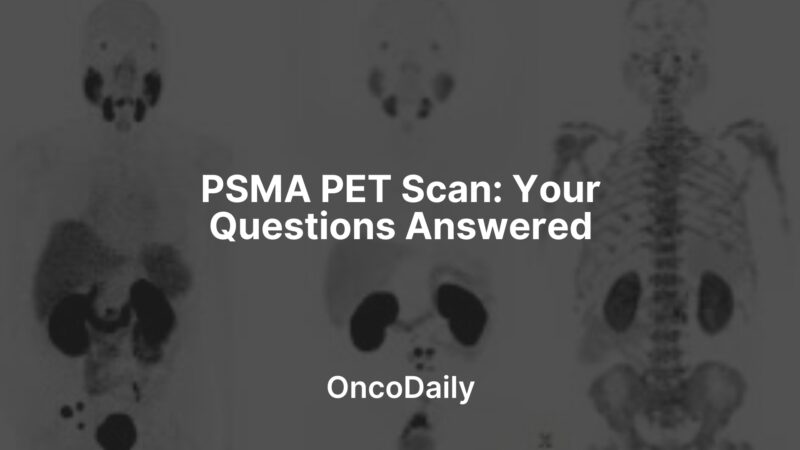 PSMA PET Scan: Your Questions Answered - OncoDaily