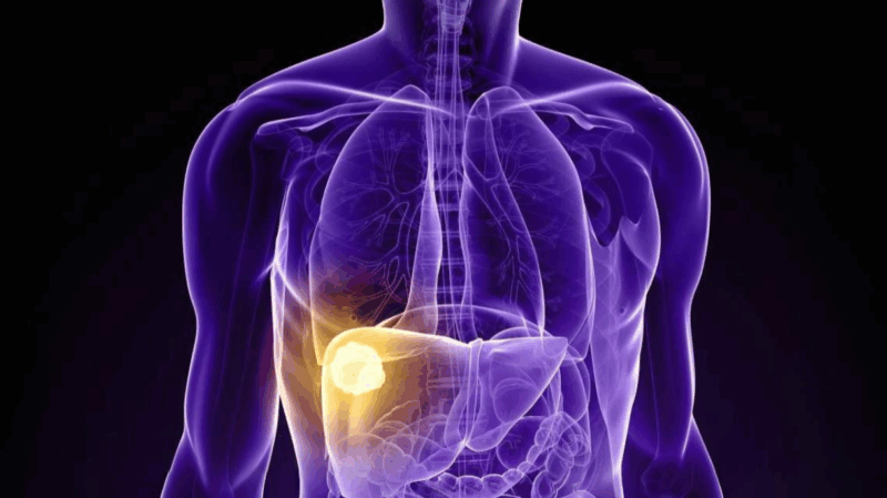 UCLA Study Identifies Key Protein that Helps Liver Cancer Resist Heat ...