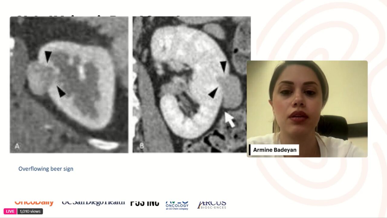 Armine Badeyan Highlights from VIRO 2025 on Radiological Assessment of ...