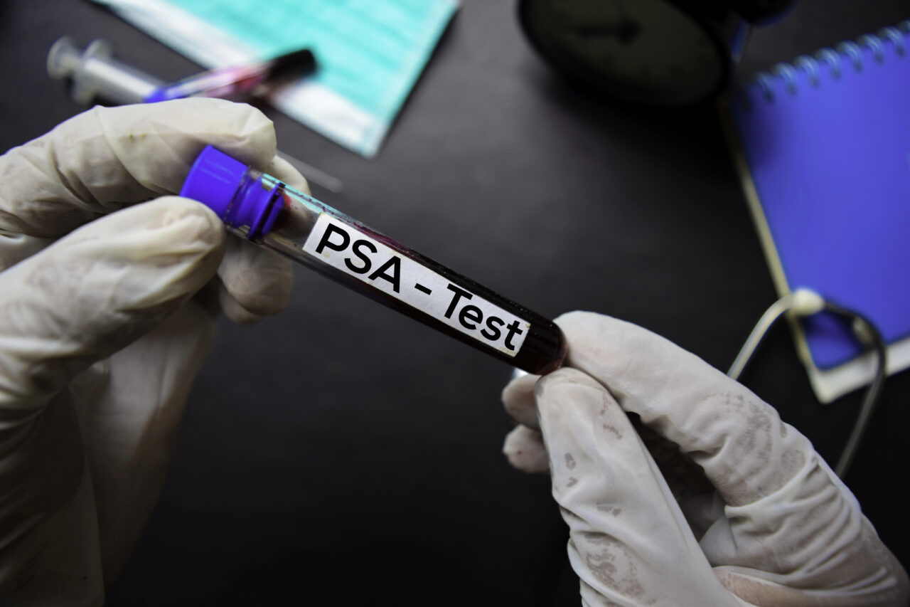Rise of Prostate Cancer in Korea Renews Push for PSA Test in National ...