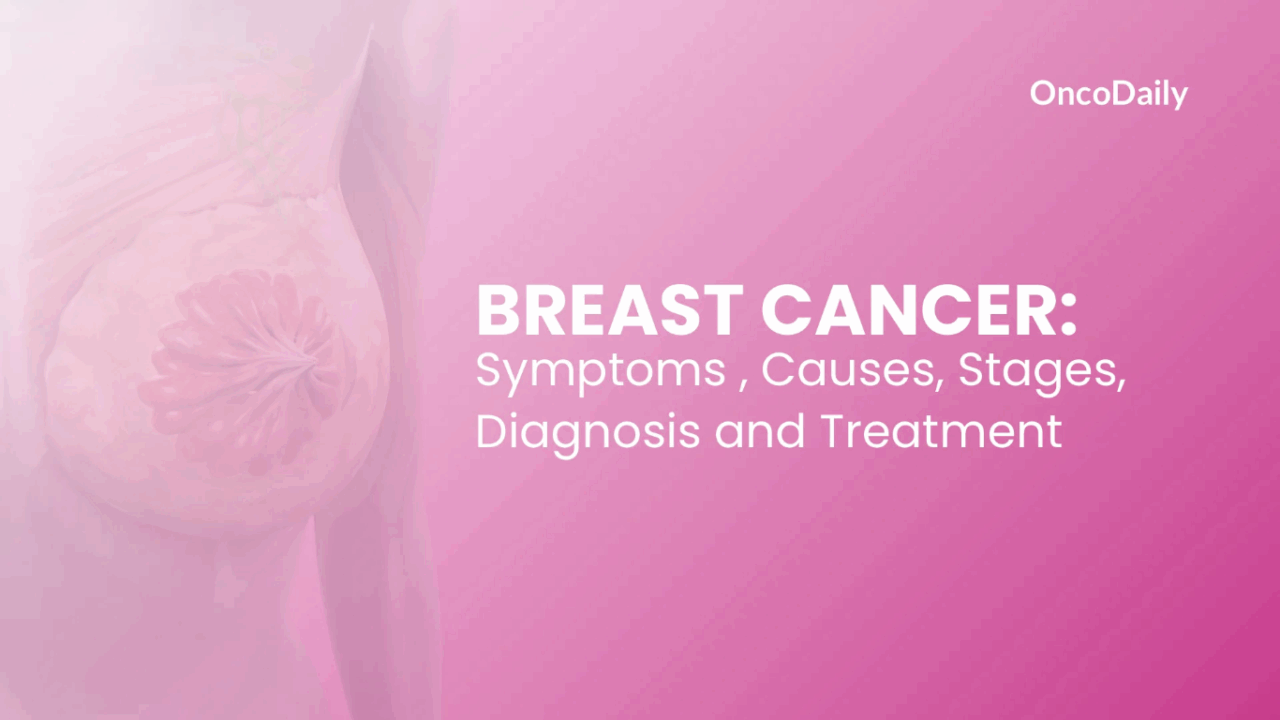 Breast Cancer Remission Rate: What Patients Need to Know in 2025 ...