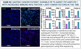 The "Off-the-Shelf" Revolution: How iNKT Cell Therapy agenT-797 is ...